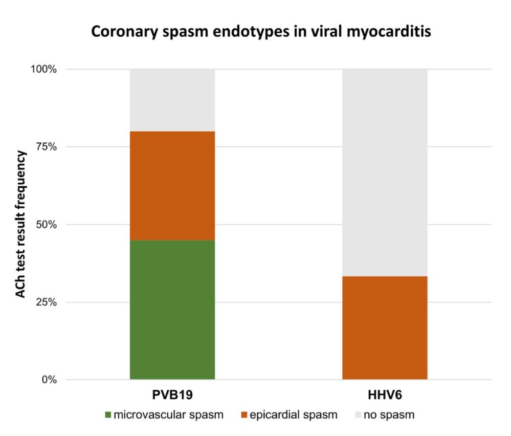 Coronary artery spasm often occurs in myocarditis cases with biopsy ...