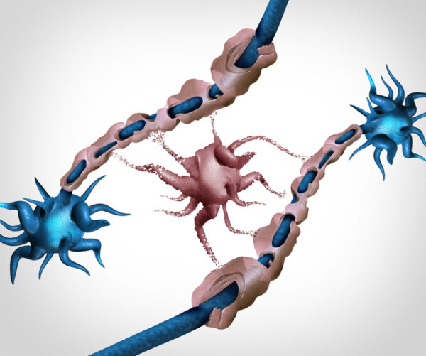 Clinical evidence that infections, including with herpesviruses ...